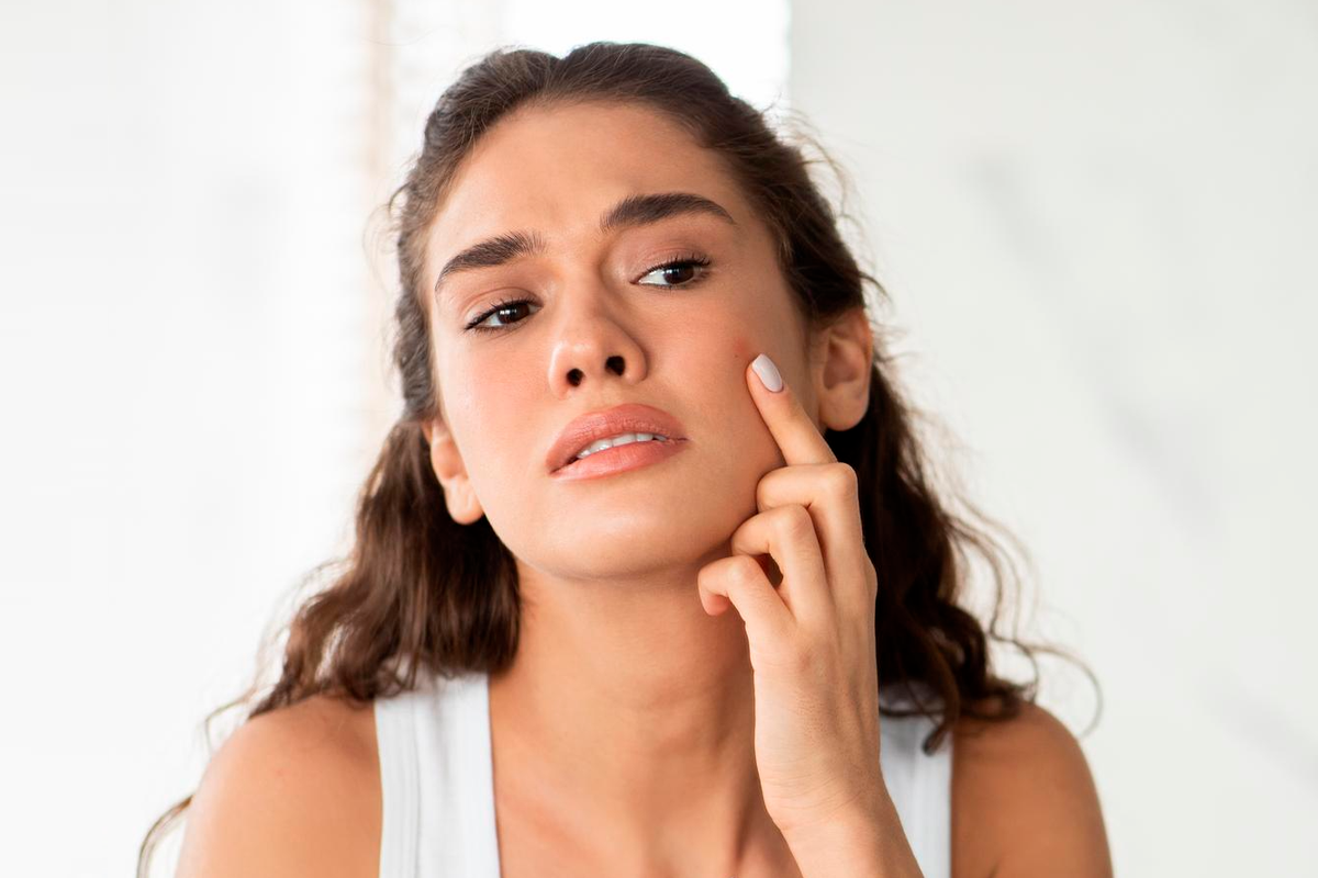 Pele opaca: descubra as principais causas - Bonita Sem Filtro