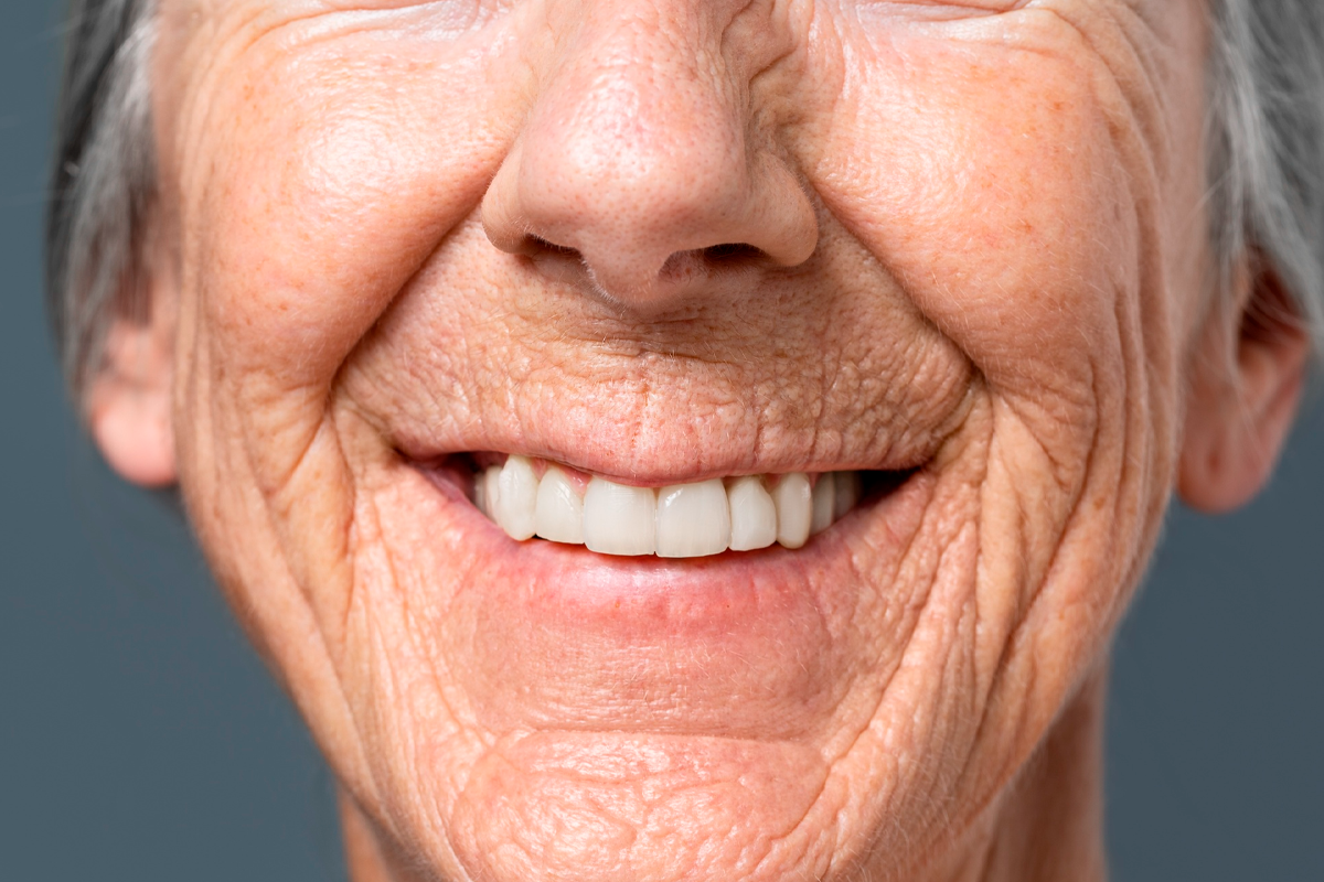 Código de Barras na Boca: O Que É, Por Que Aparece e Como Prevenir ...